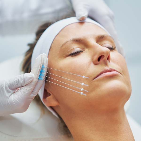 PDO THREADS (LIFT) – Skingoodies Australia